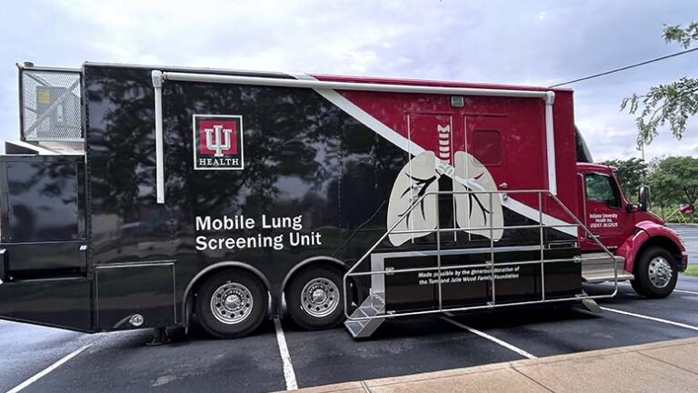 Mobile Lung Screening Unit to Make Stop in Muncie on October 20 ...